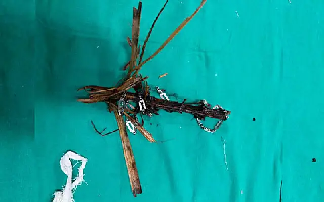 Doctors at Wenlock Hospital Save 12-Year-Old with Complex Surgery ...